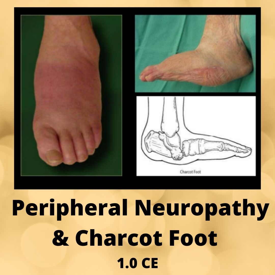 Peripheral Neuropathy and Charcot Neuroarthropathy - Advanced Training ...